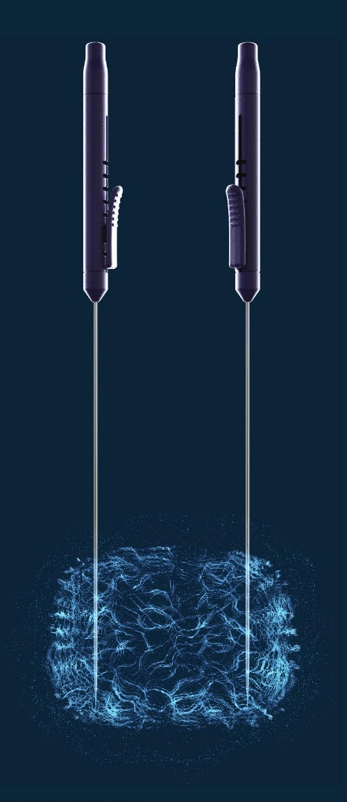 Nanoknife Focal Therapy for Prostate Cancer | Main