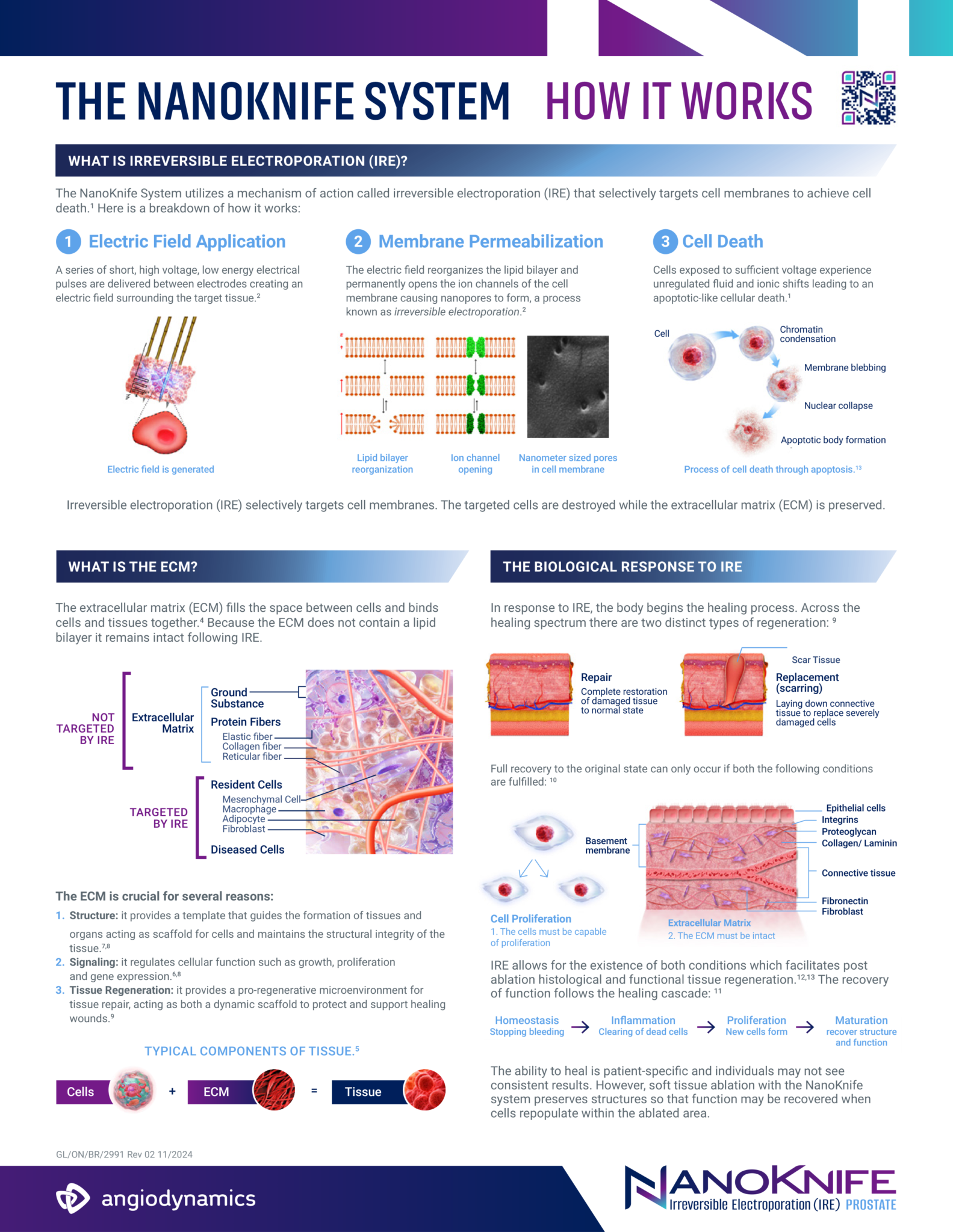 Nanoknife Focal Therapy for Prostate Cancer | Main